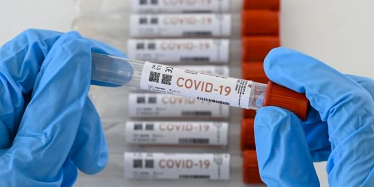 Boletín #1: Aumentan muertes y contagios por la COVID-19 en Colombia ... Boletín #1: Aumentan muertes y contagios por la COVID-19 en Colombia ...