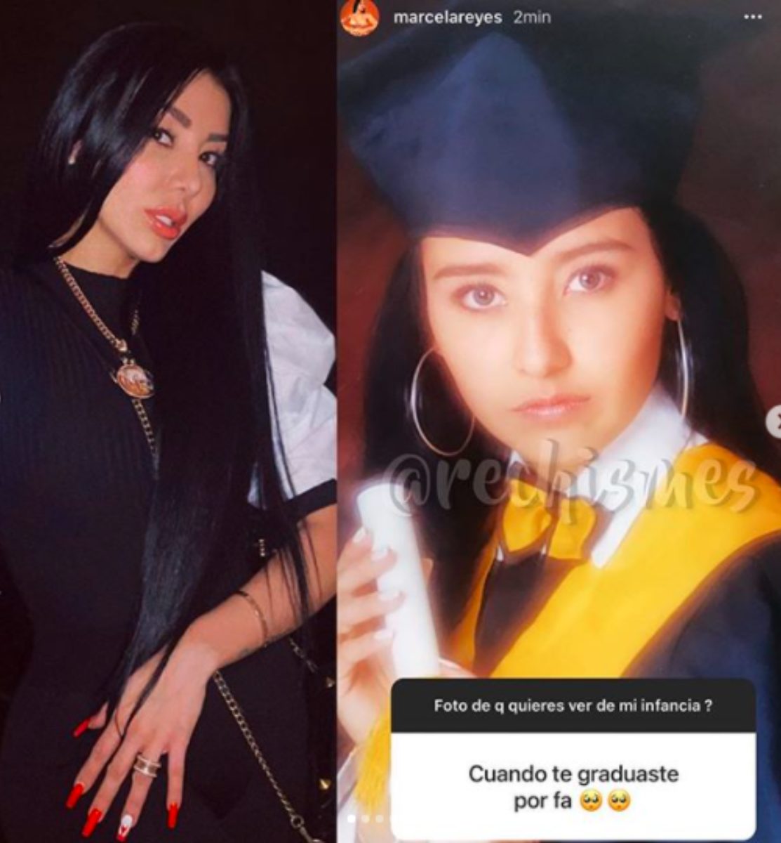 Marcela Reyes cirugías antes y después de ser famosa - Canal 1