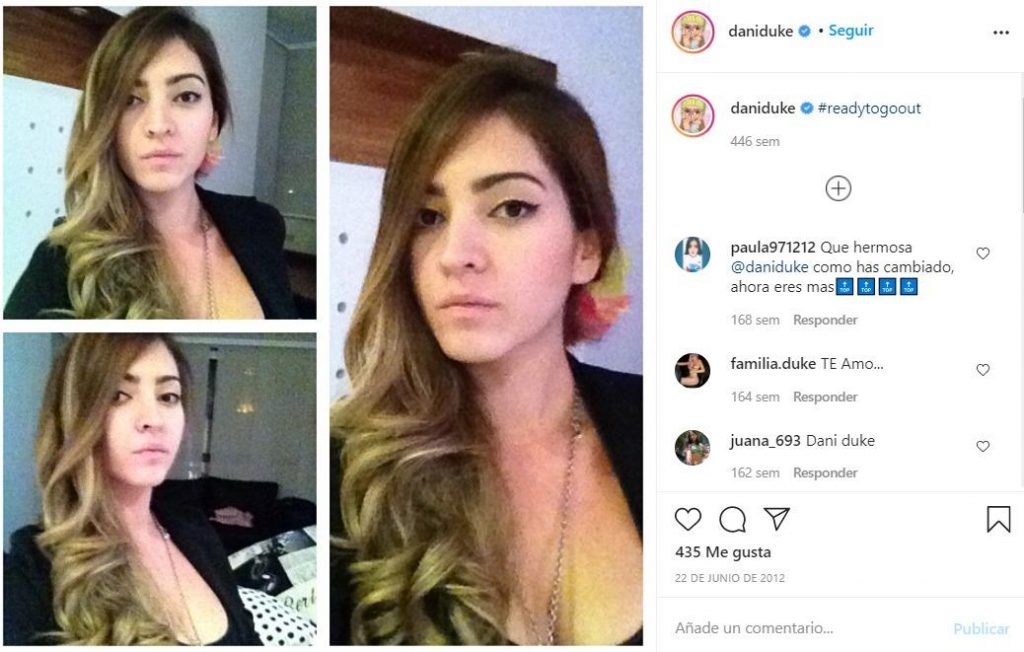 Dani Duke antes de cirugías: el drástico cambio de la influencer - Canal 1