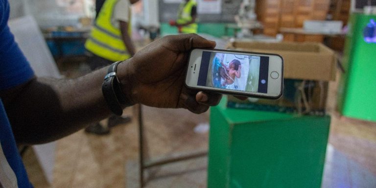 Cola humana de 12 centímetros de largo fotos y videos - Canal 1