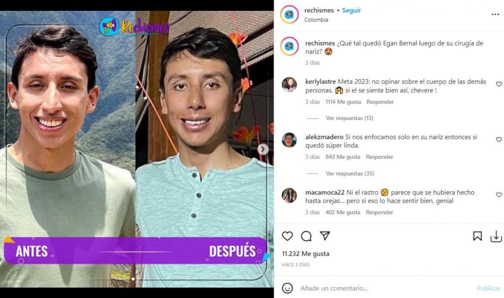 Egan Bernal nariz: cambio físico hoy del ciclista colombiano - Canal 1