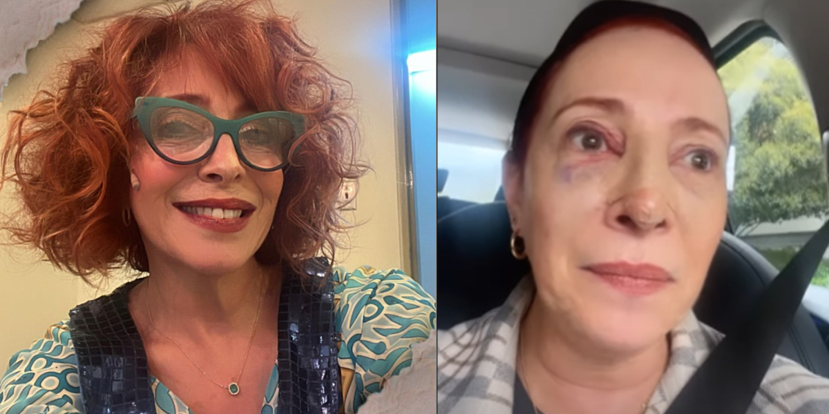 Yaneth Waldman entro al quirófano tras sufrir accidente - Canal 1