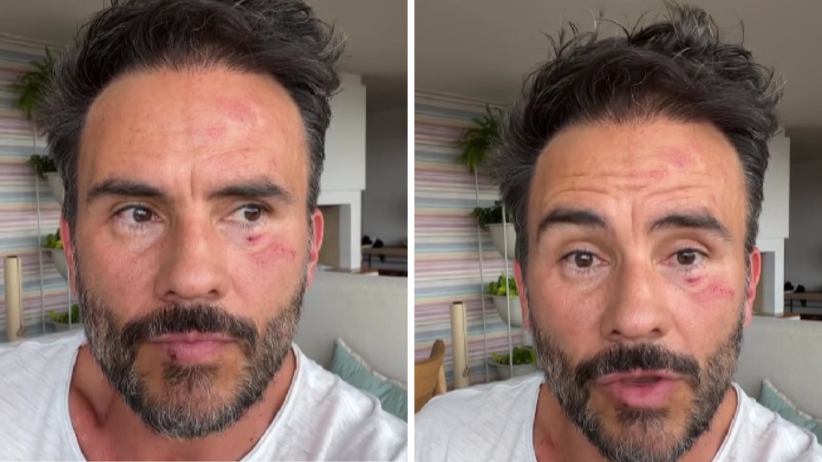 Juan Pablo Raba fue robado y golpeado en Bogotá: “Estaba con mis hijos ...