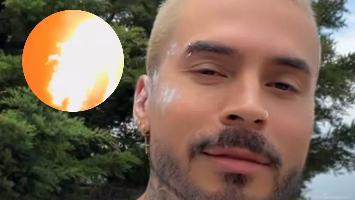 Reikon cuenta como se recupera después de que su cabeza se prendió en ...