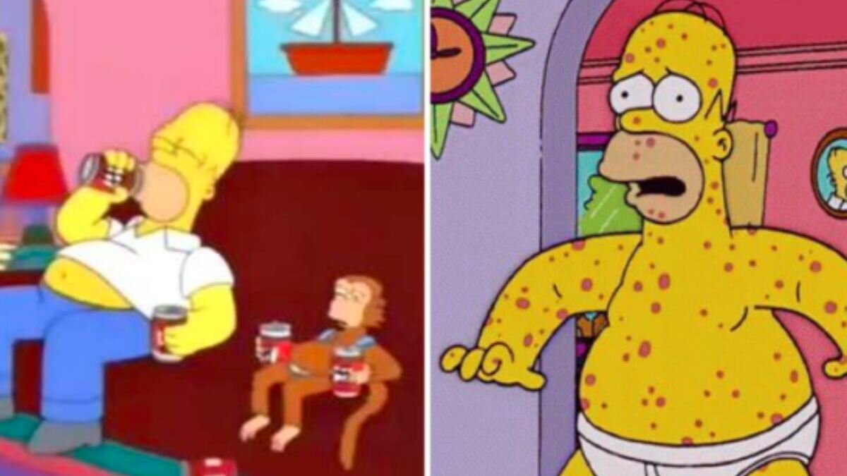 Los mejores memes que nos ha dejado la viruela del mono - Canal 1