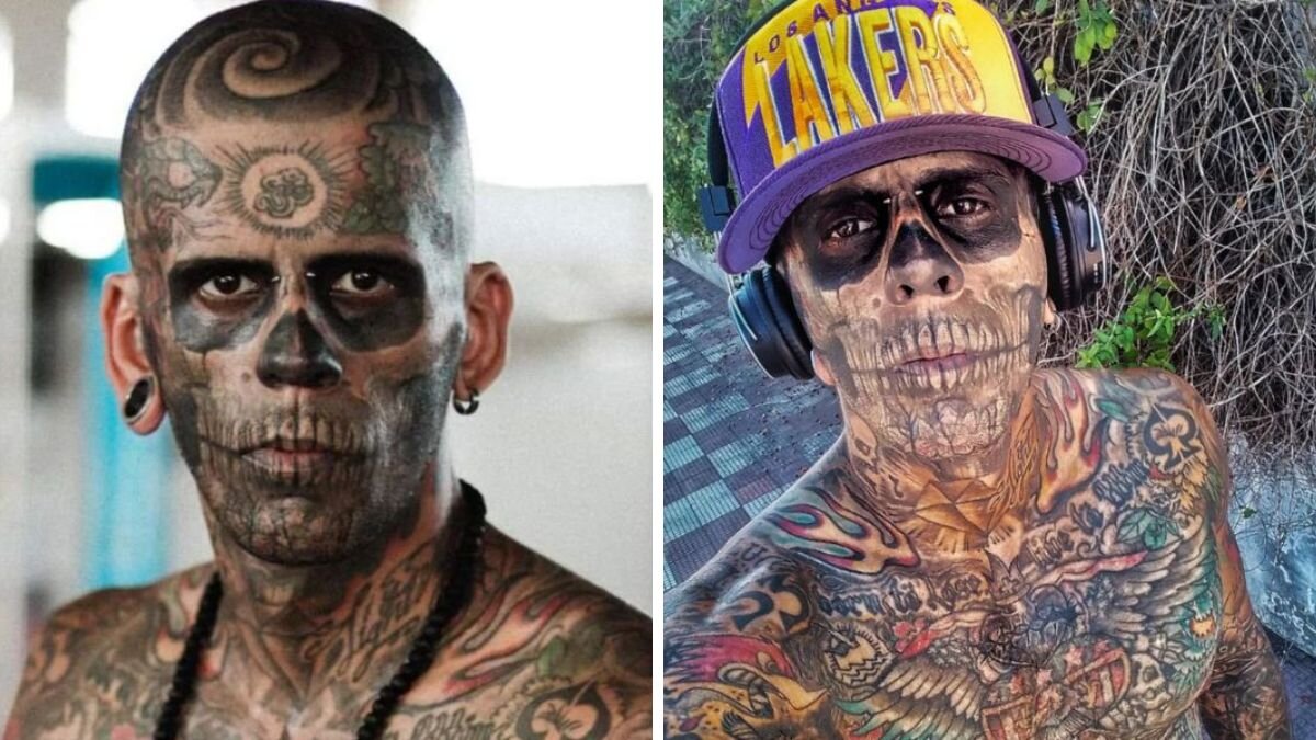 Así se ve el hombre más tatuado de Brasil tras quitarse los tatuajes ...