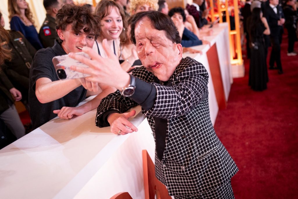 ¿Quién es Adam Pearson y cuál es su enfermedad? | Noticias Barranquilla